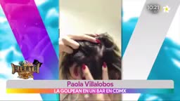 Golpean a Paola Villalobos en un bar de CDMX