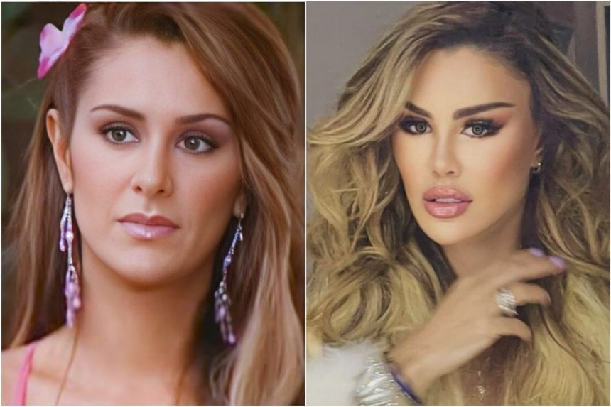 Ninel Conde: el antes y después de sus cirugías